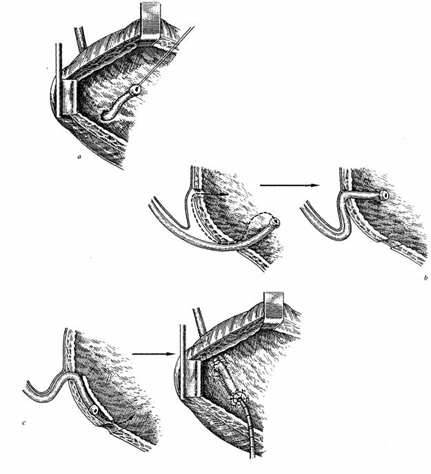 Hội Tiết niệu - Thận học TP. HCM